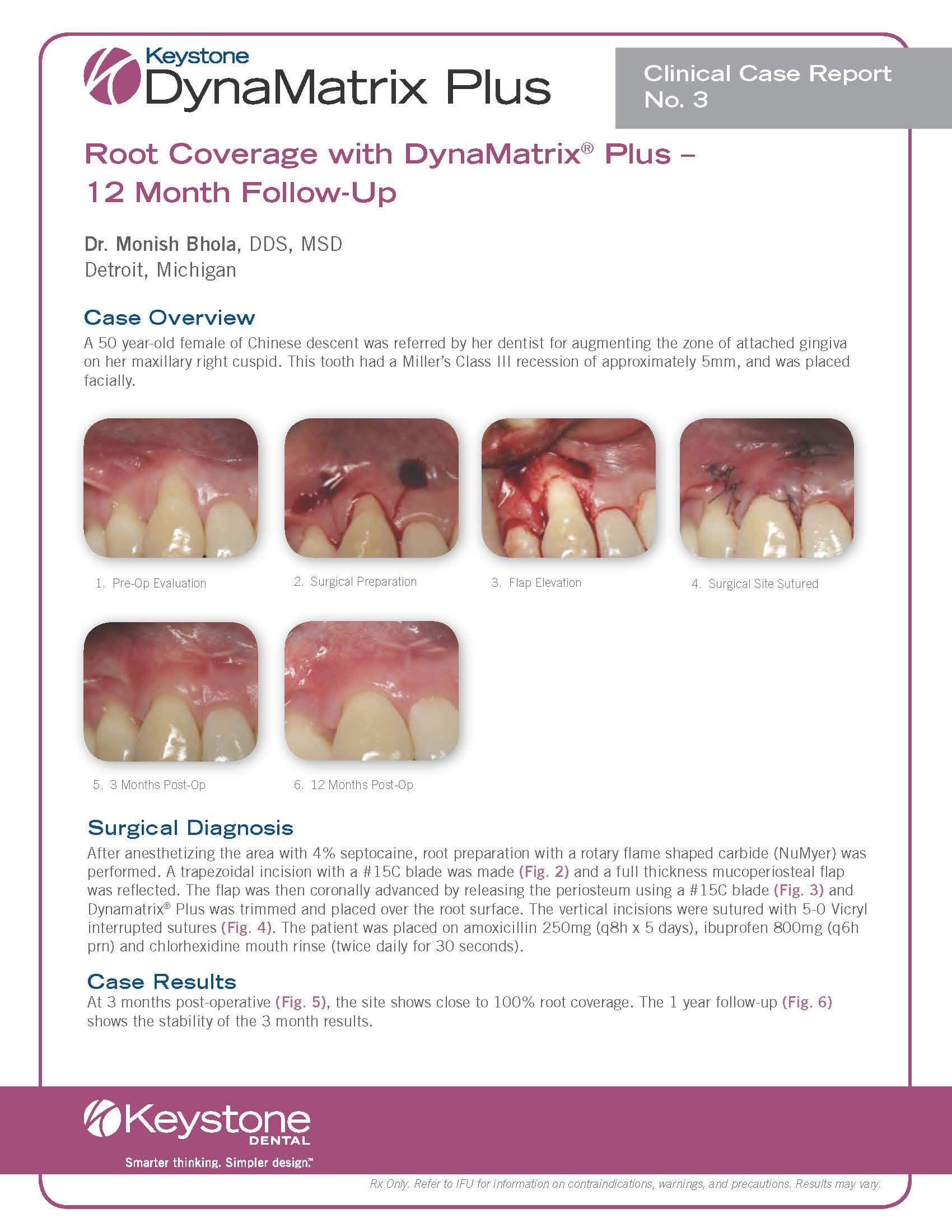 口腔修复膜 – 台昌国际贸易